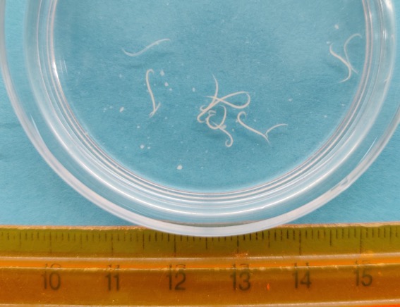 Image:Heterakis gallinarum, pollo-Manual de veterinaria de MSD