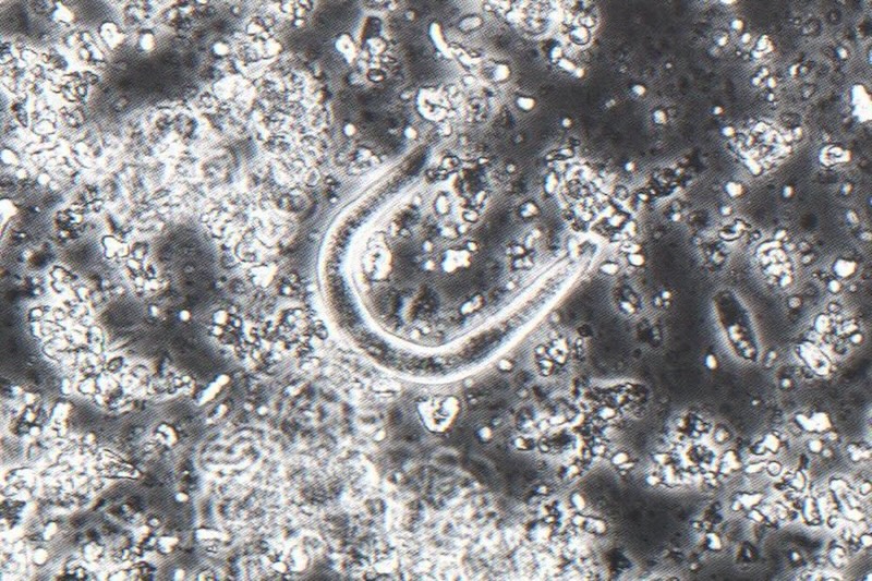 Image:Hookworm (Kalicephalus spp) larva, blood python-MSD Veterinary Manual