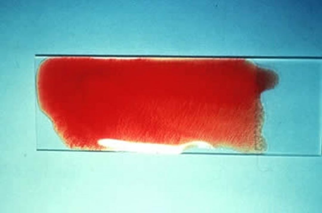 Regenerative Anemias in Animals - Circulatory System - MSD Veterinary ...