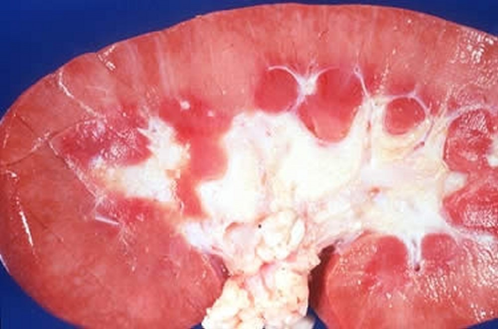 Image:Nefritis intersticial, leptospirosis, cerdo-Manual de veterinaria de MSD