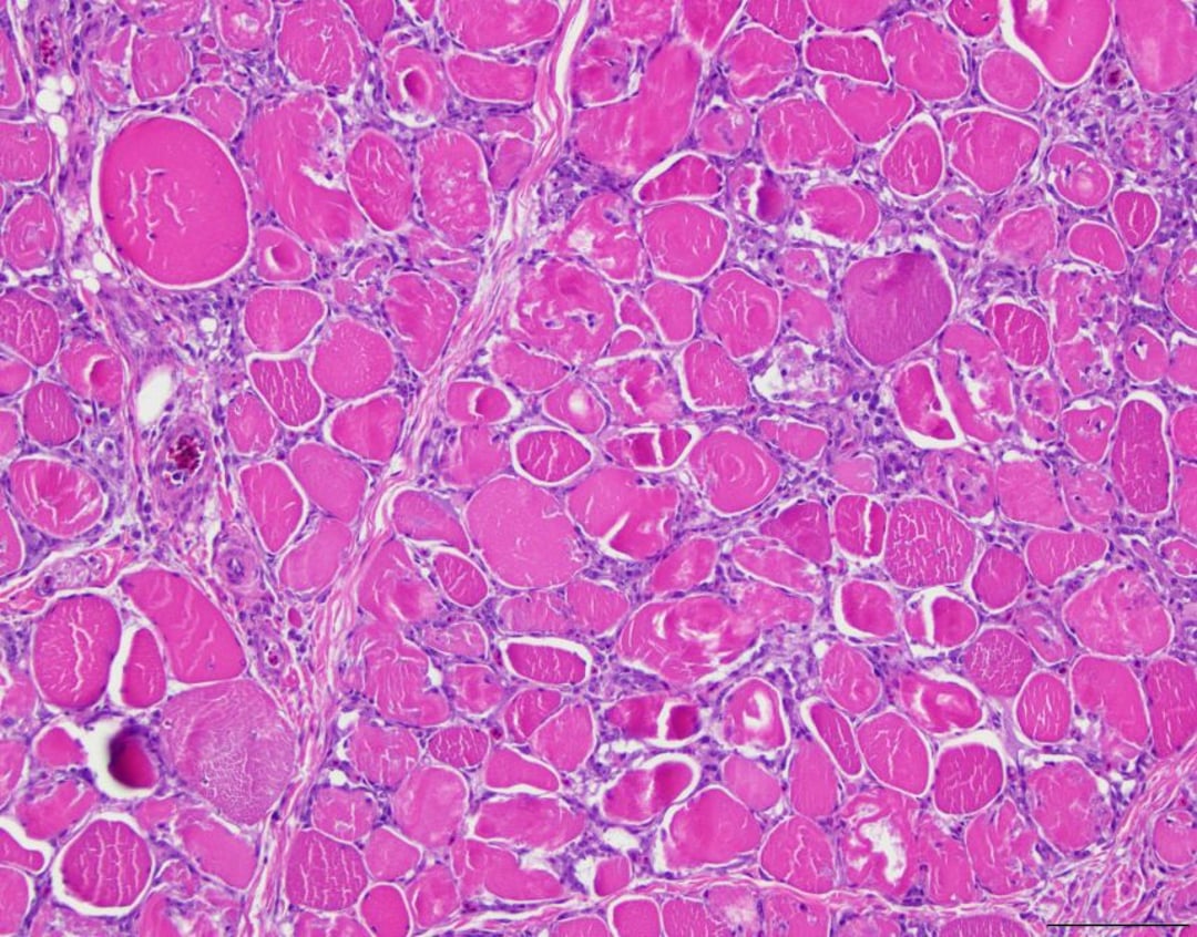 Toxic Myopathy in Poultry - Poultry - MSD Veterinary Manual
