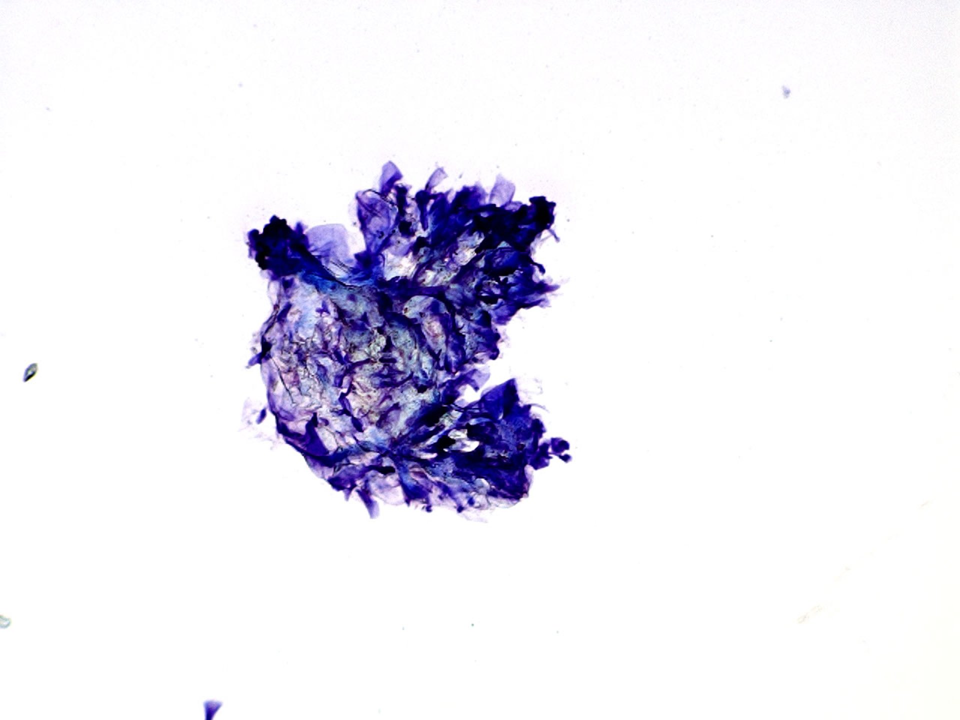 Image:Keratin clump, cytology-Merck Veterinary Manual
