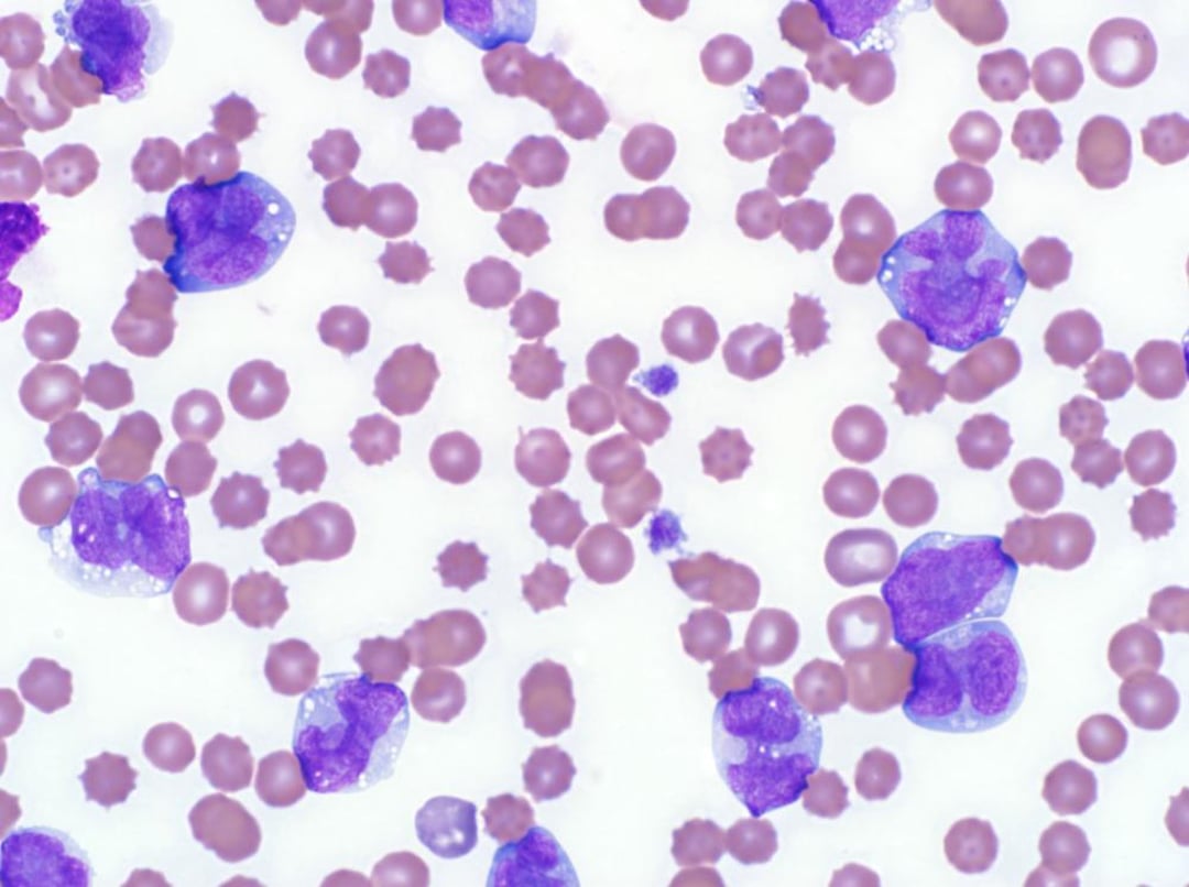 Leukogram Abnormalities in Animals - Leukogram Abnormalities in Animals ...