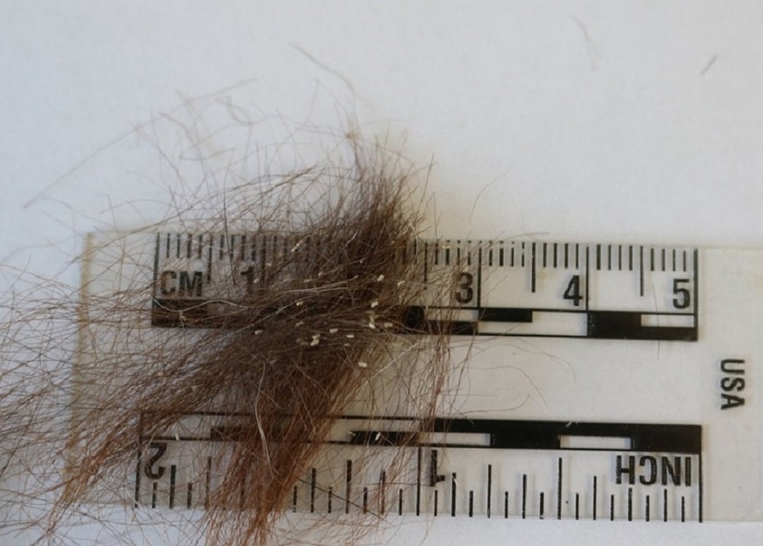 Overview of Lice in Animals - Integumentary System - MSD Veterinary Manual