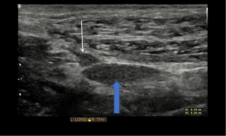 Image:Thyroid, longitudinal ultrasonography, dog-Merck Veterinary Manual