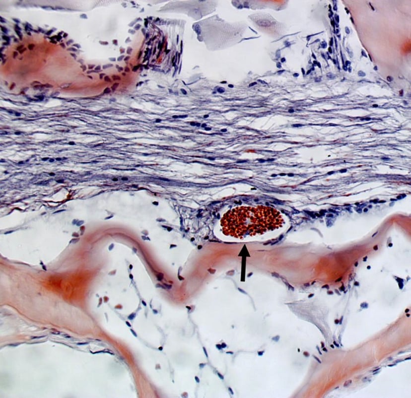 Image:Microsporidia, spinal cord of zebrafish-Merck Veterinary Manual