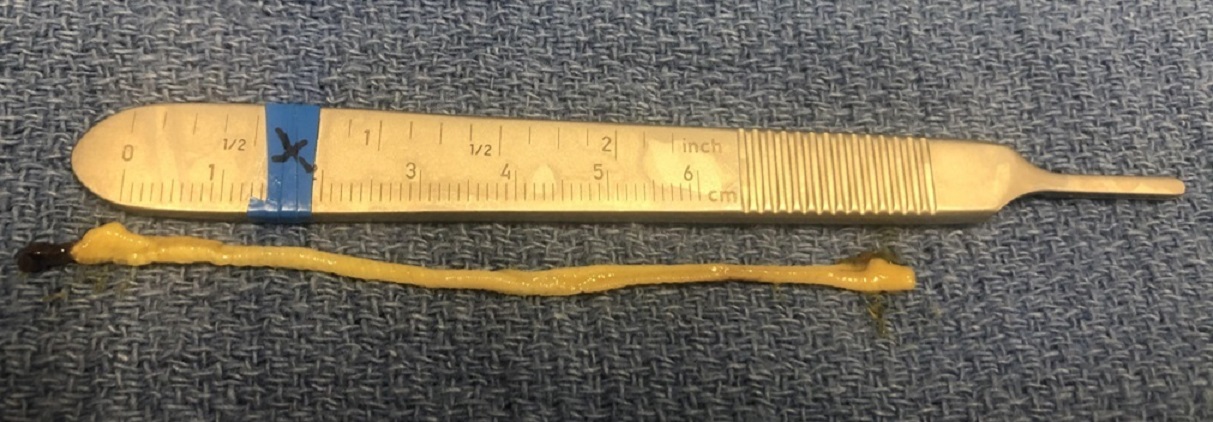 Image:Moniezia tapeworm passed in goat feces-MSD Veterinary Manual