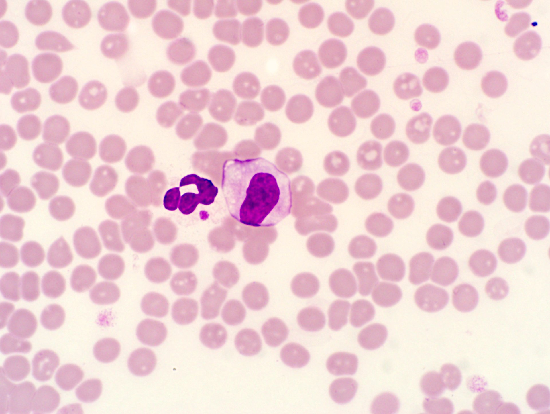 Leukogram Abnormalities in Animals - Leukogram Abnormalities in Animals ...