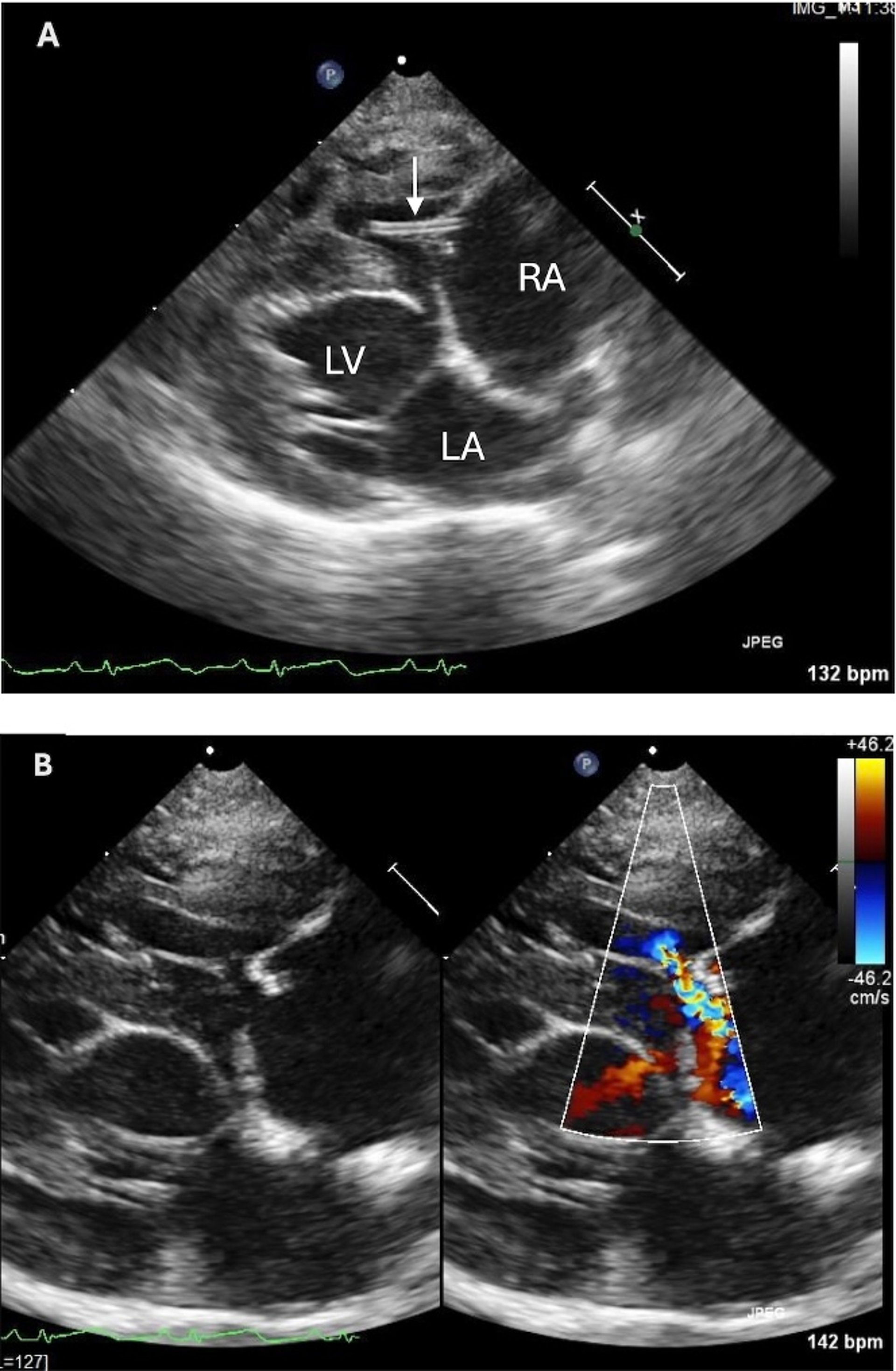 Image:Mature heartworm infection, echocardiogram, cat-Merck Veterinary ...