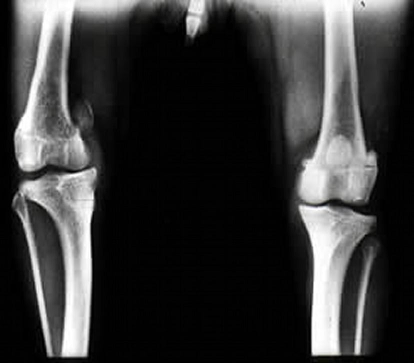 Patellar Luxation in Dogs and Cats - Musculoskeletal System - MSD ...