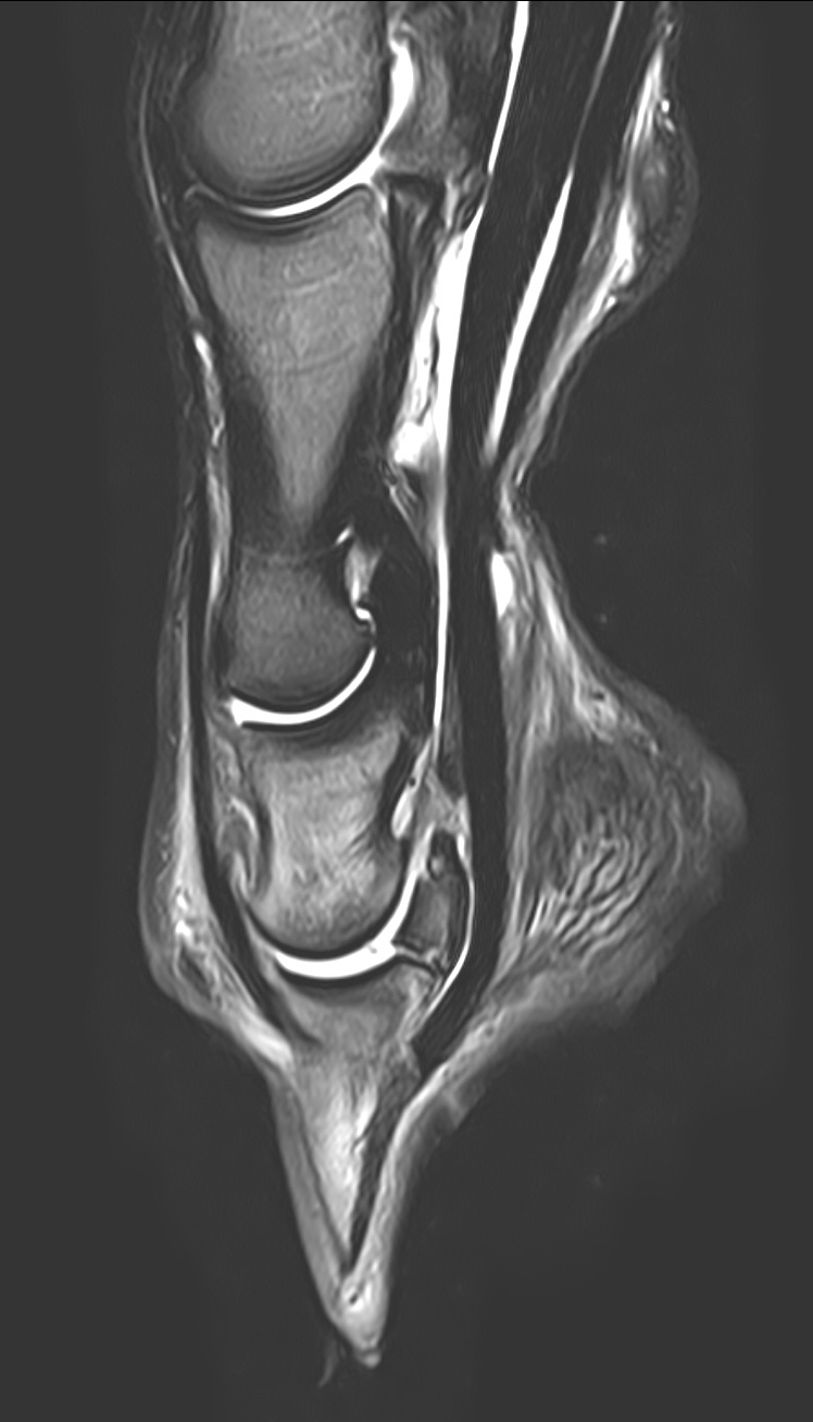 Image:RM sagital media, dígito, caballo-Manual de veterinaria de Merck