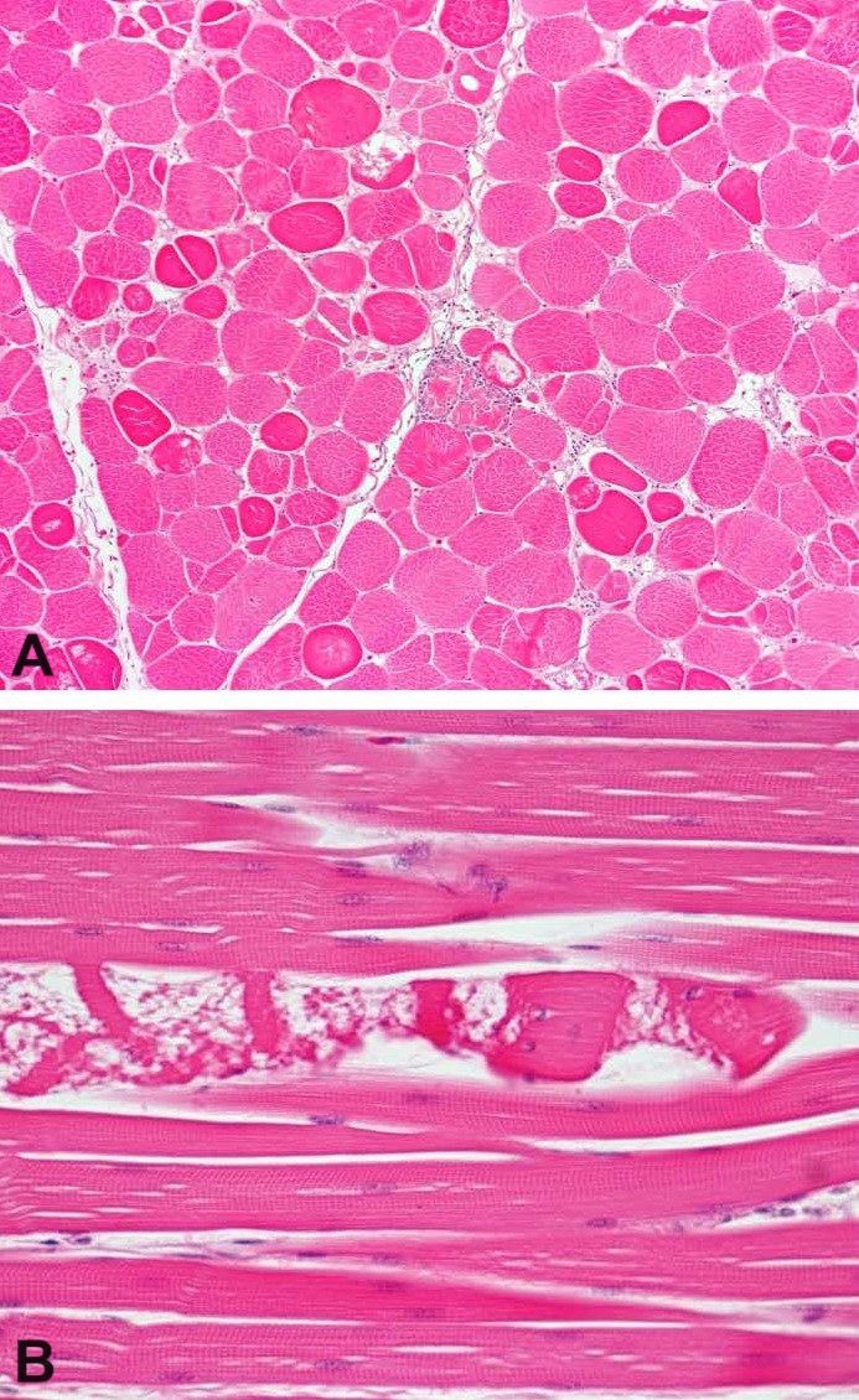 Image:Minimal myopathy, photomicrographs, broiler-Merck Veterinary Manual