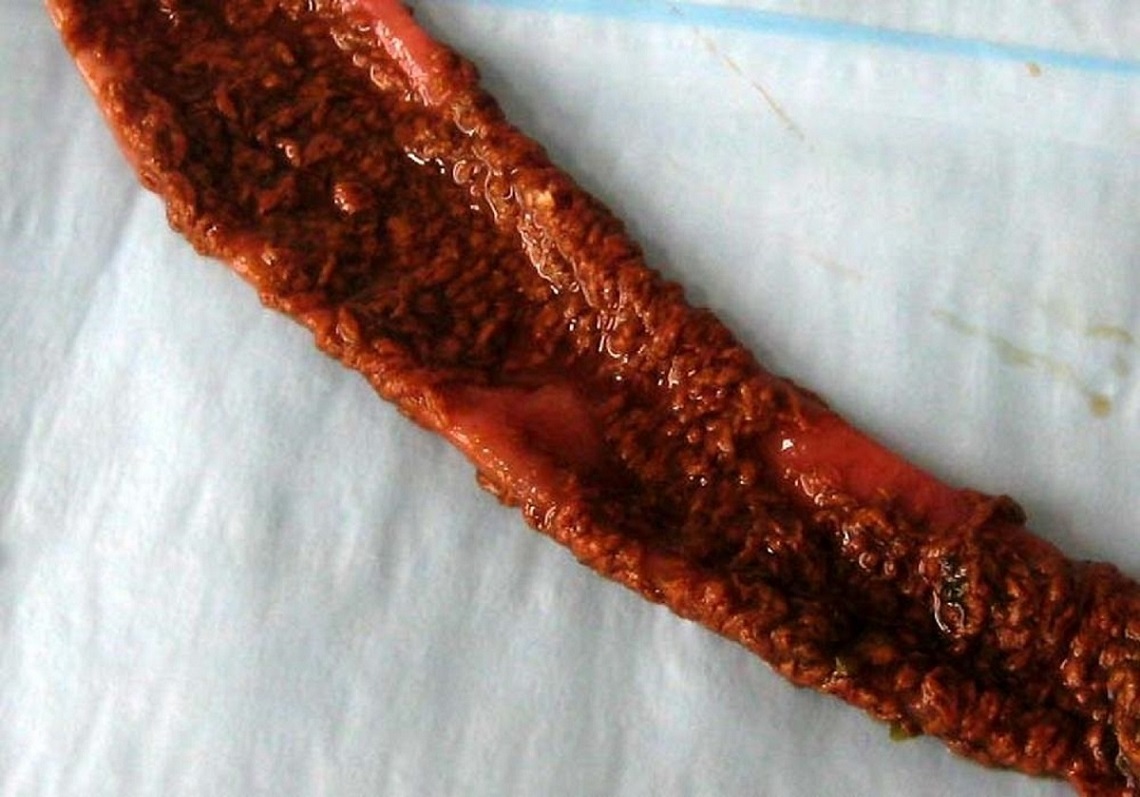 Image:Necrotic enteritis, small intestine, chicken-MSD Veterinary Manual