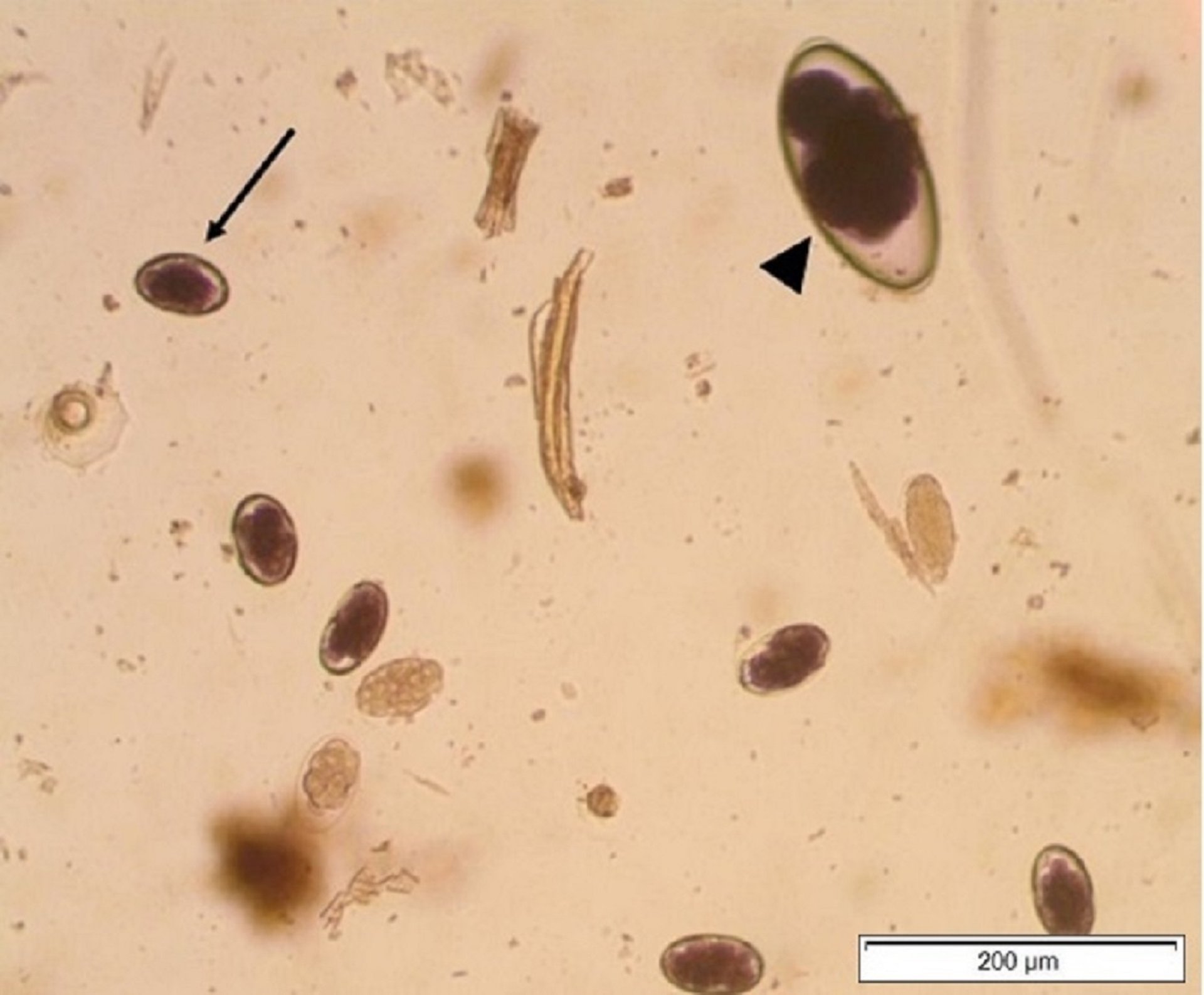 Image:Nematodirus eggs-Merck Veterinary Manual