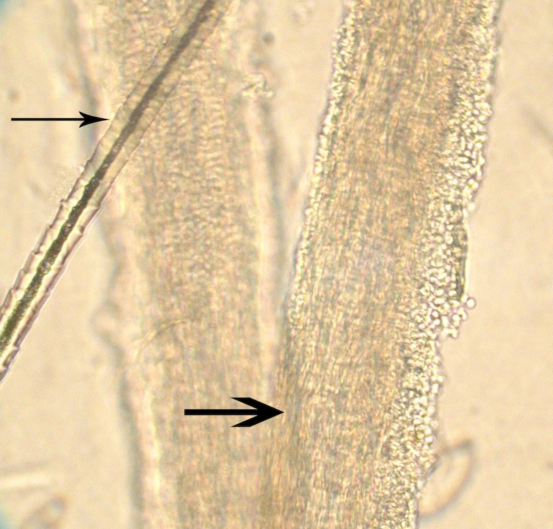 Image:Pelo normal y pelo infectado por Microsporum canis-Manual de ...