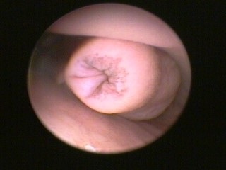 Balanoposthitis in Dogs and Cats - Reproductive System - Merck ...