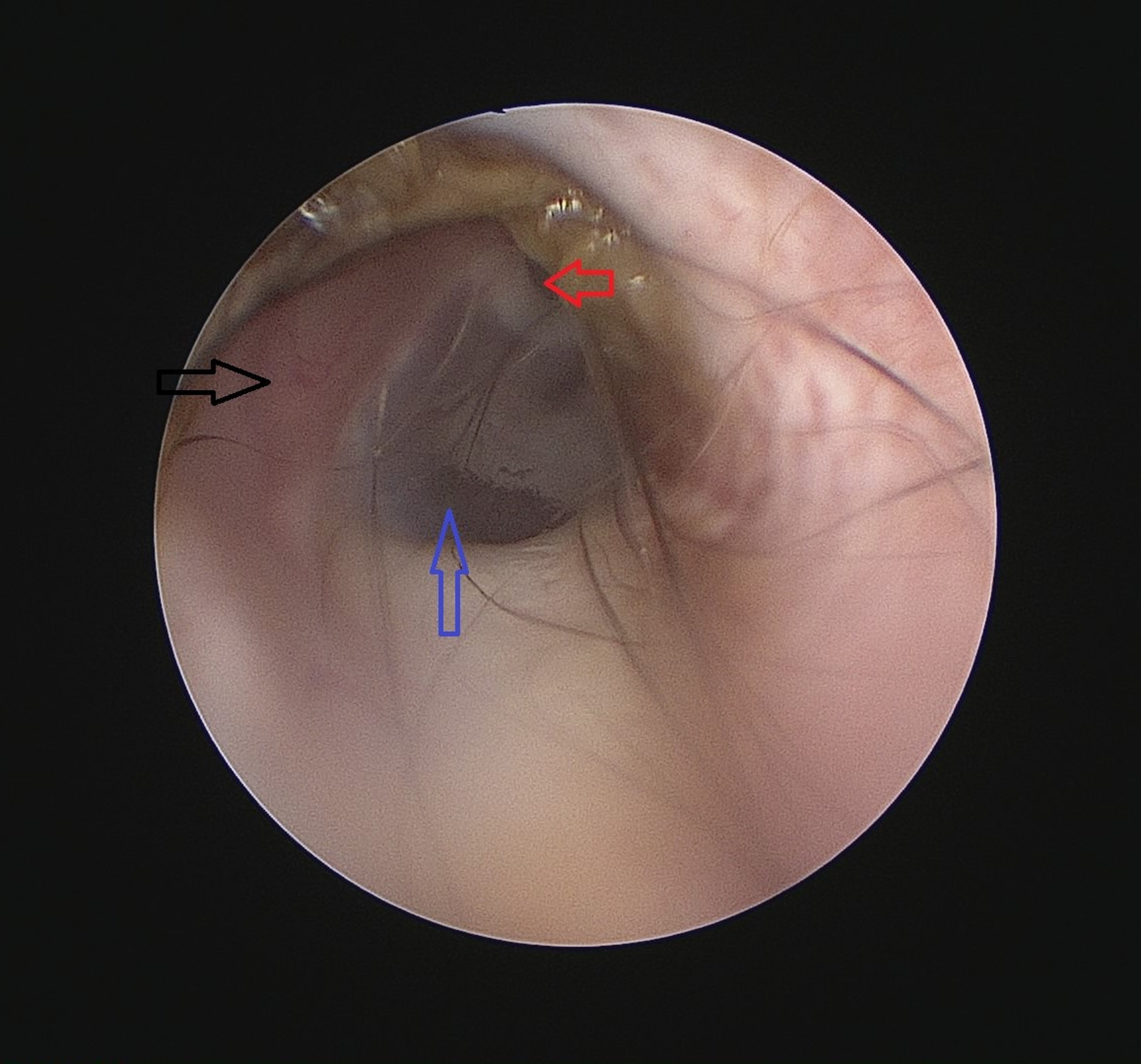 Image:Normal tympanic membrane, otoscopic examination, dog-MSD ...