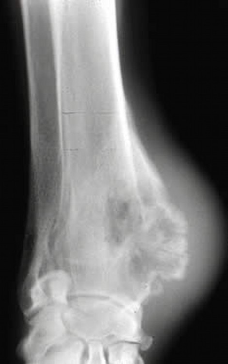 Image:Osteosarcoma, radiograph, dog-Merck Veterinary Manual