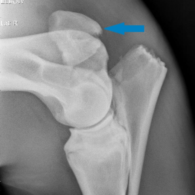 Disorders of the Elbow in Horses - Musculoskeletal System - MSD ...