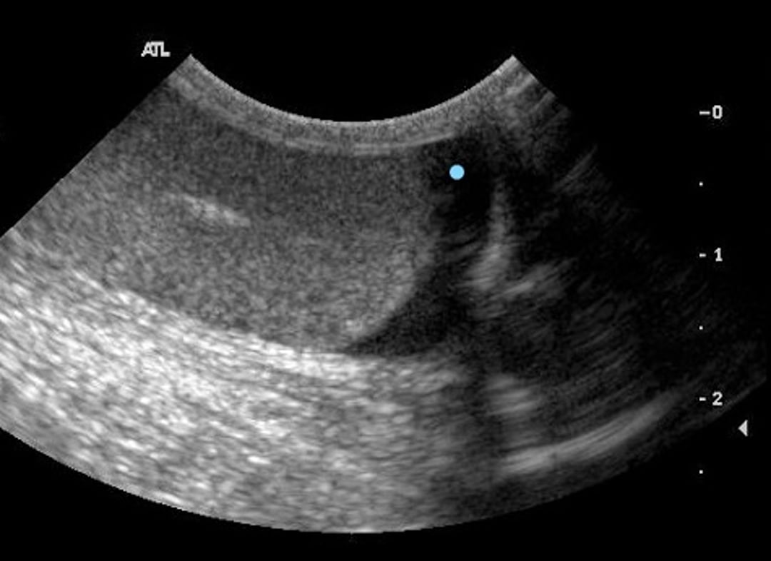 Image:Orchitis and epididymitis, scrotal edema, ultrasonogram, dog ...