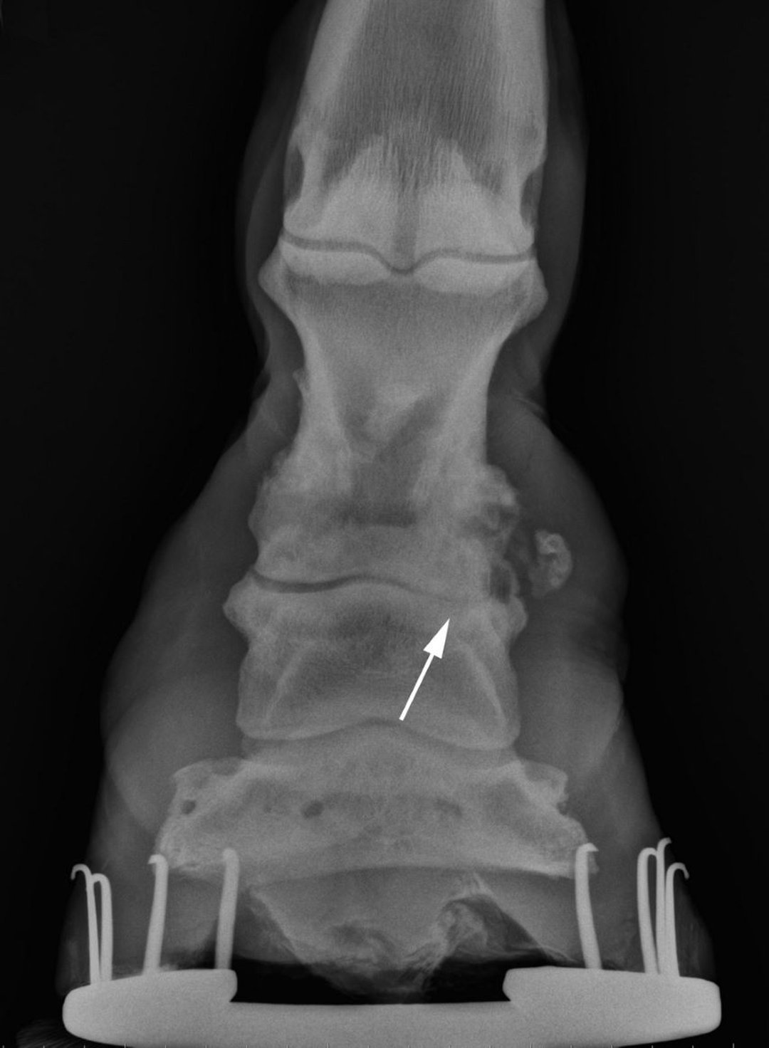 Image:Osteoarthritis, proximal interphalangeal joint, radiograph, horse ...