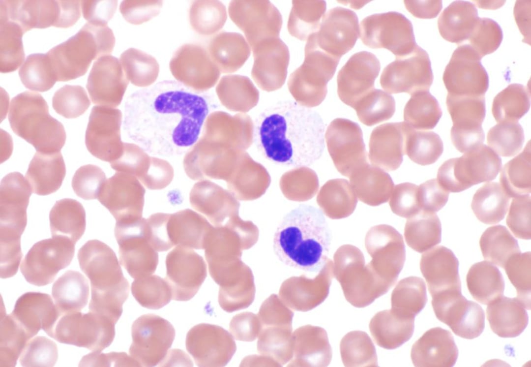 Leukogram Abnormalities in Animals - Leukogram Abnormalities in Animals ...