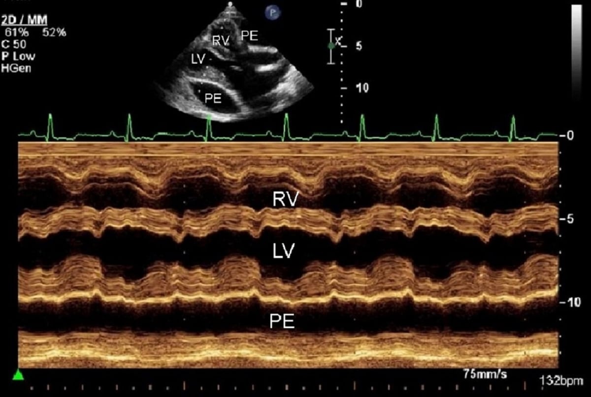 Pericardial Disease in Dogs and Cats - Circulatory System - Merck ...