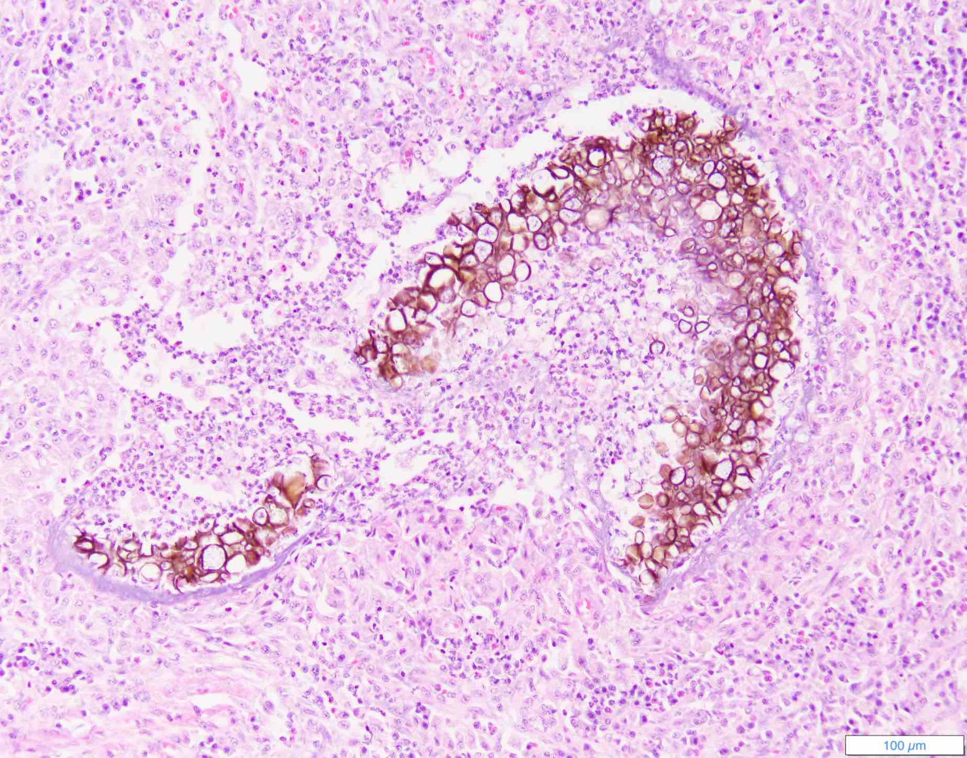 Phaeohyphomycosis in Animals - Infectious Diseases - MSD Veterinary Manual