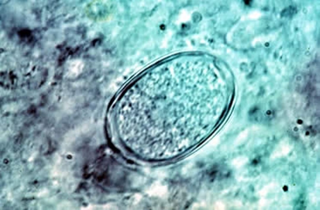 Coccidiosis in Poultry - Poultry - Merck Veterinary Manual