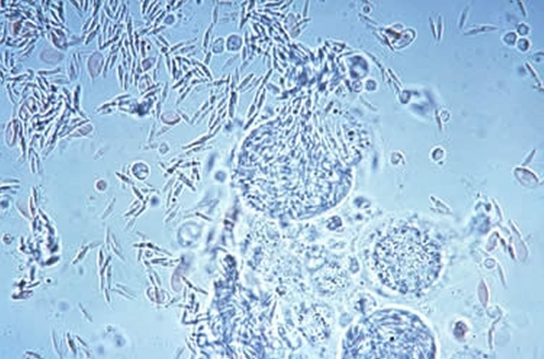 Coccidiosis in Poultry - Poultry - Merck Veterinary Manual