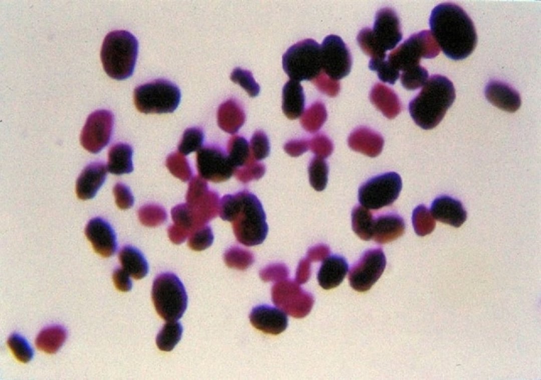 Protothecosis in Animals - Generalized Conditions - Merck Veterinary Manual