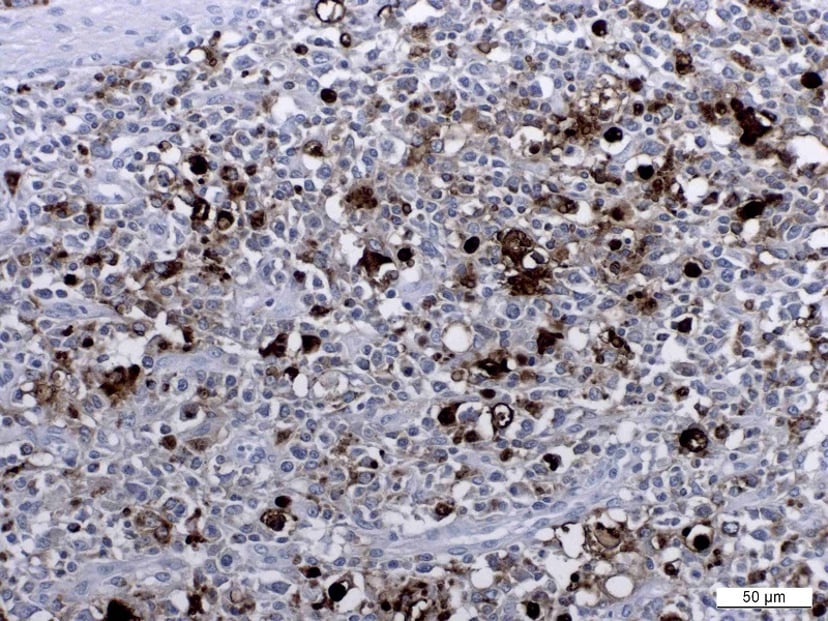 Enfermedades asociadas al circovirus porcino - Enfermedades ...