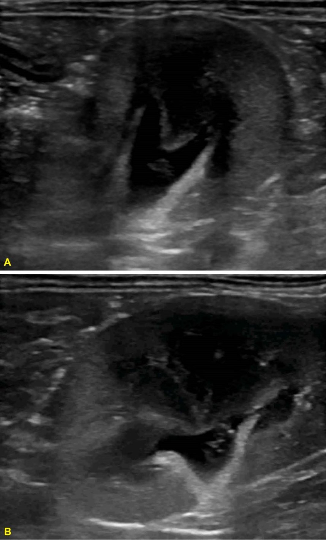Obstructive Uropathy in Dogs and Cats - Urinary System - Merck ...
