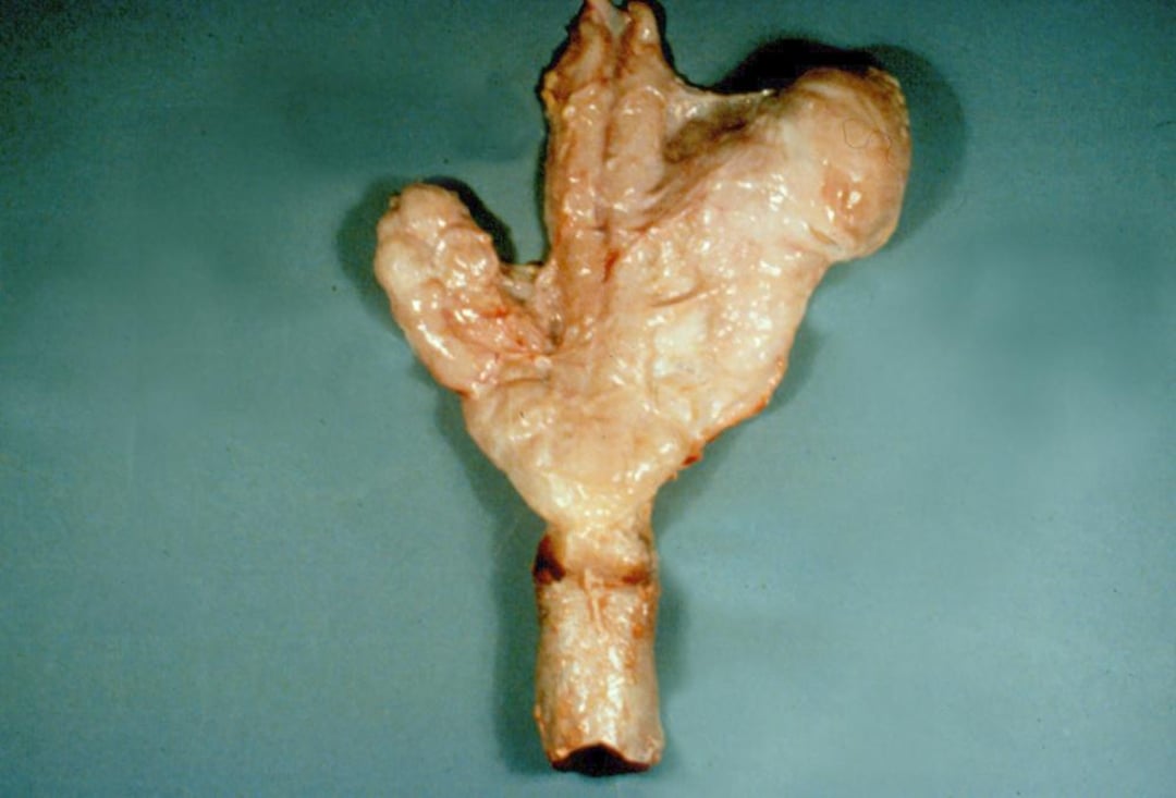 Vesicular Adenitis (Vesiculitis) in Bulls - Reproductive System - MSD ...