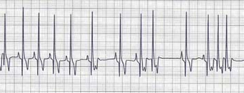 Image:Pulseless electrical activity, ECG tracing-MSD Veterinary Manual