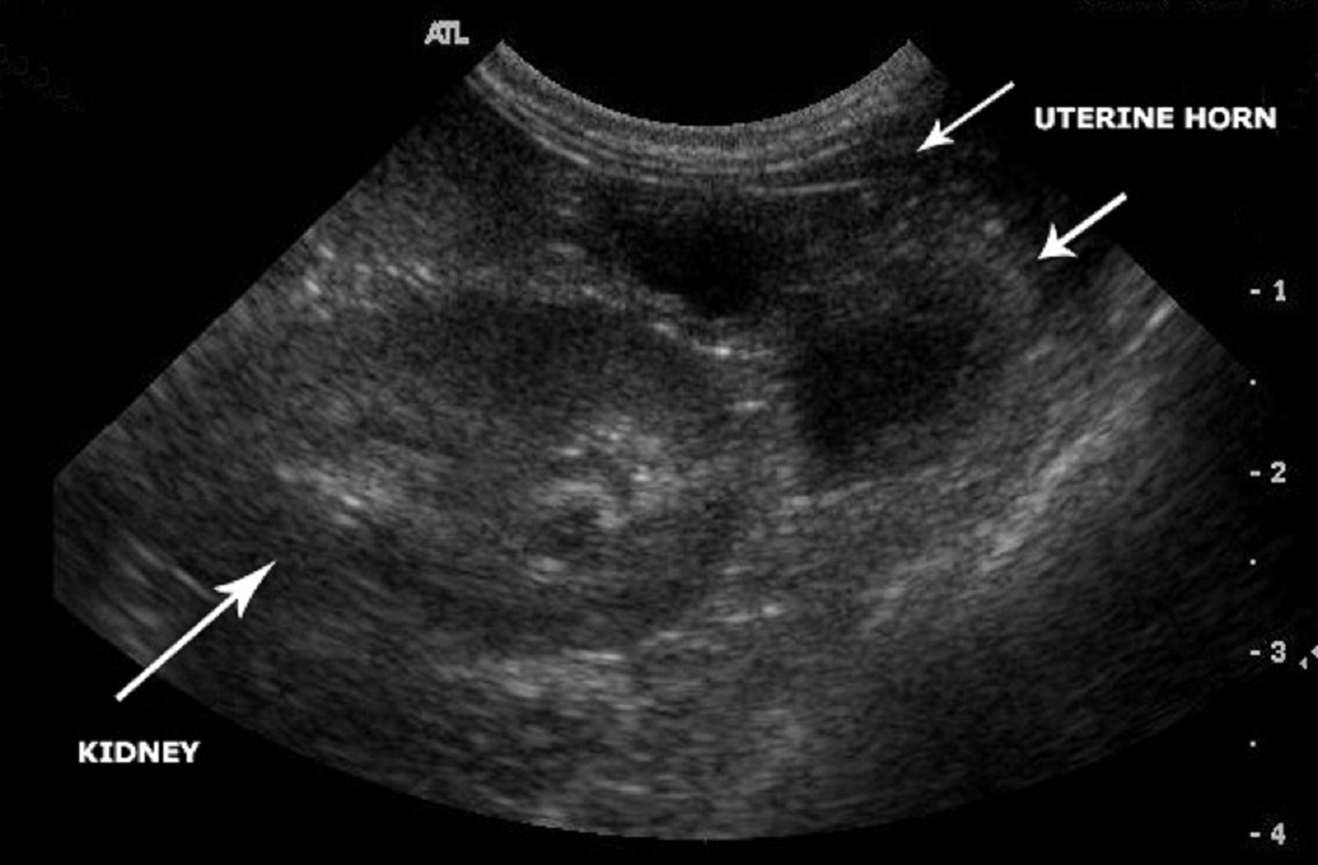 Image:Pyometra, cat (ultrasound)-MSD Veterinary Manual