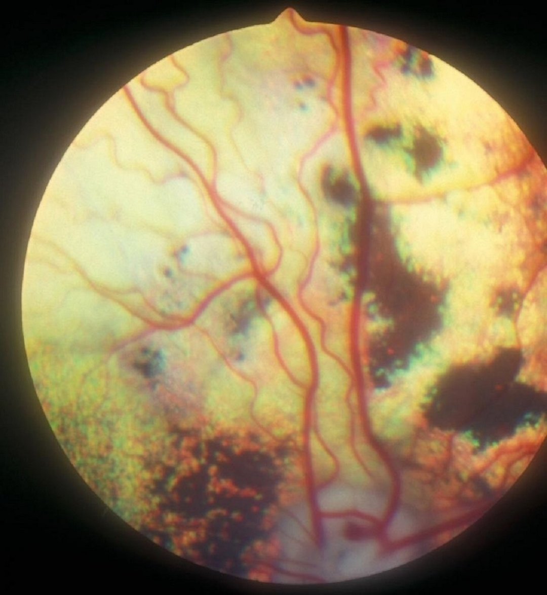 The Ocular Fundus in Animals - Eye Diseases and Disorders - Merck ...
