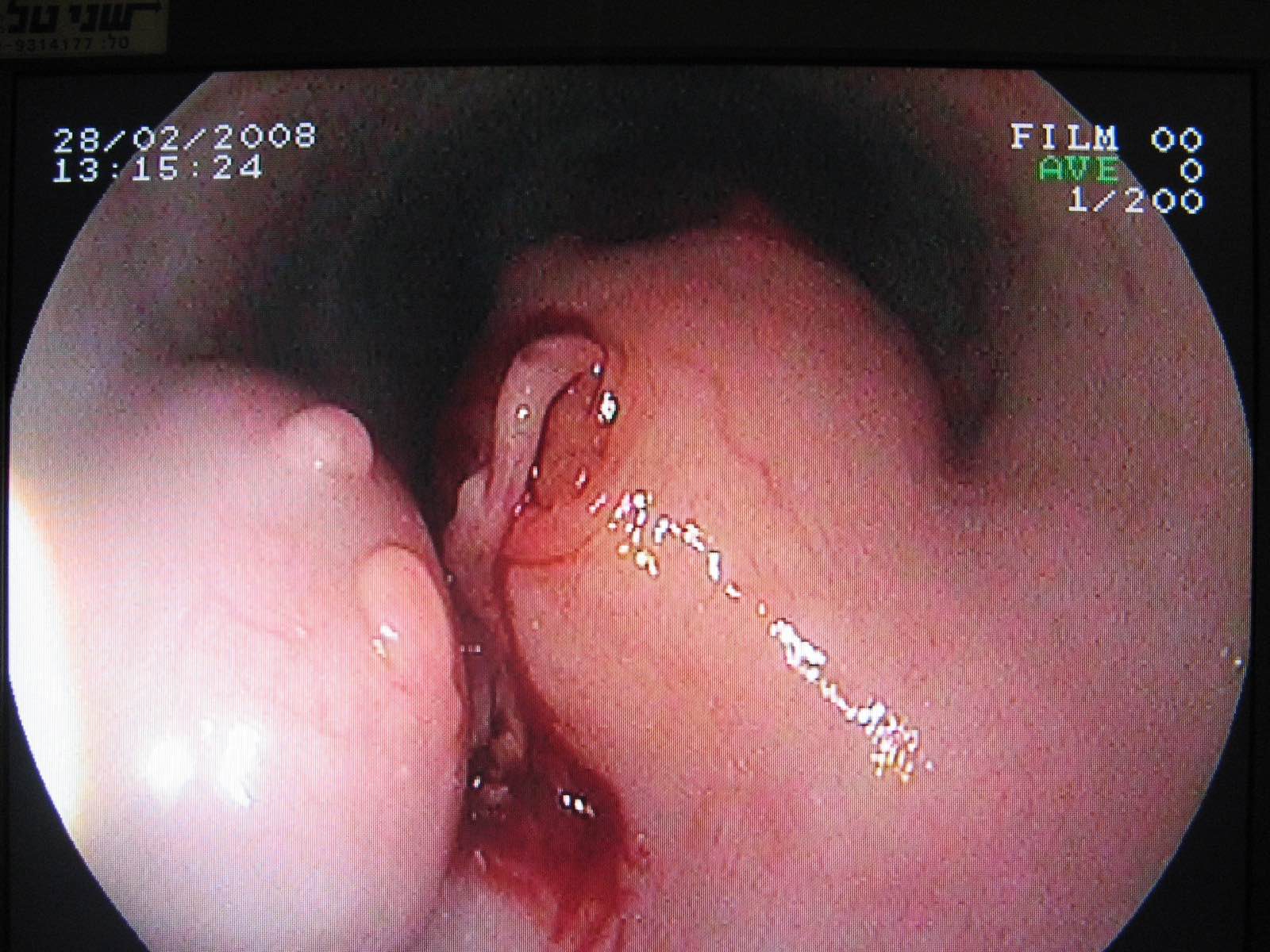 Image:Esophageal endoscopy, dog-Merck Veterinary Manual