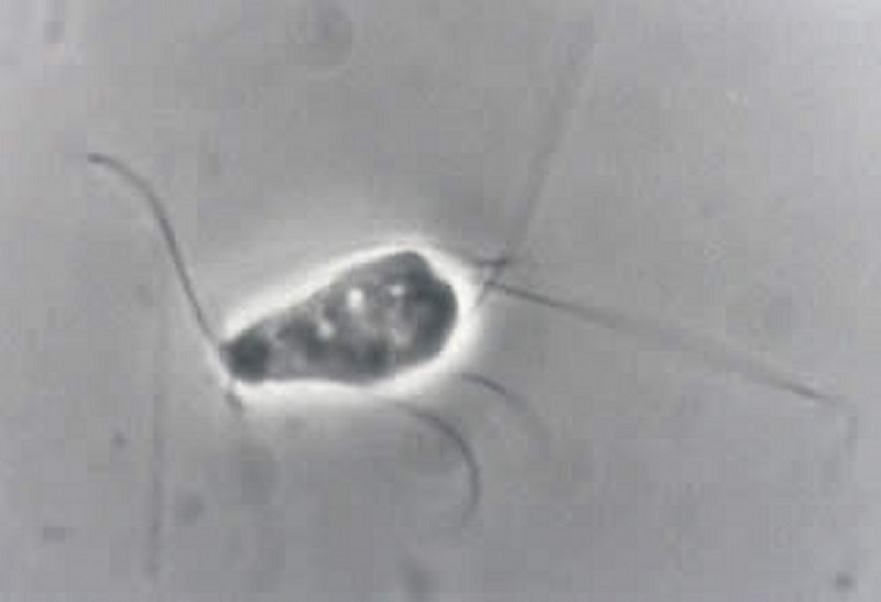 Image:Spironucleus vortens, angelfish-Merck Veterinary Manual