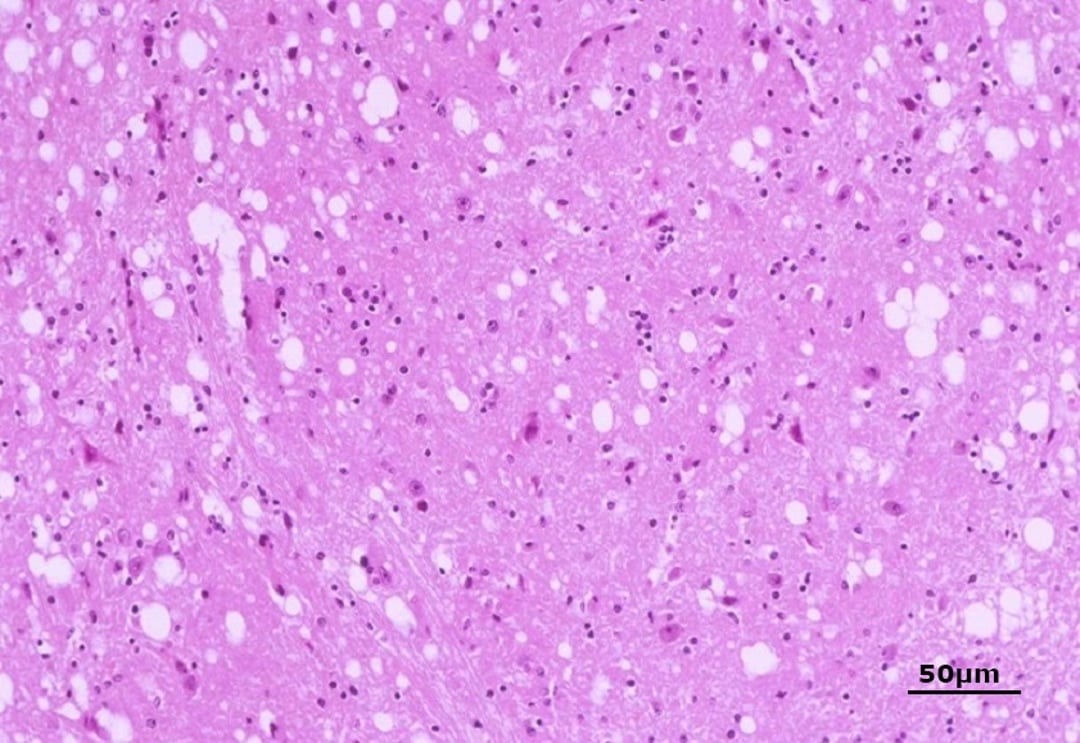 Bovine Spongiform Encephalopathy - Nervous System - MSD Veterinary Manual