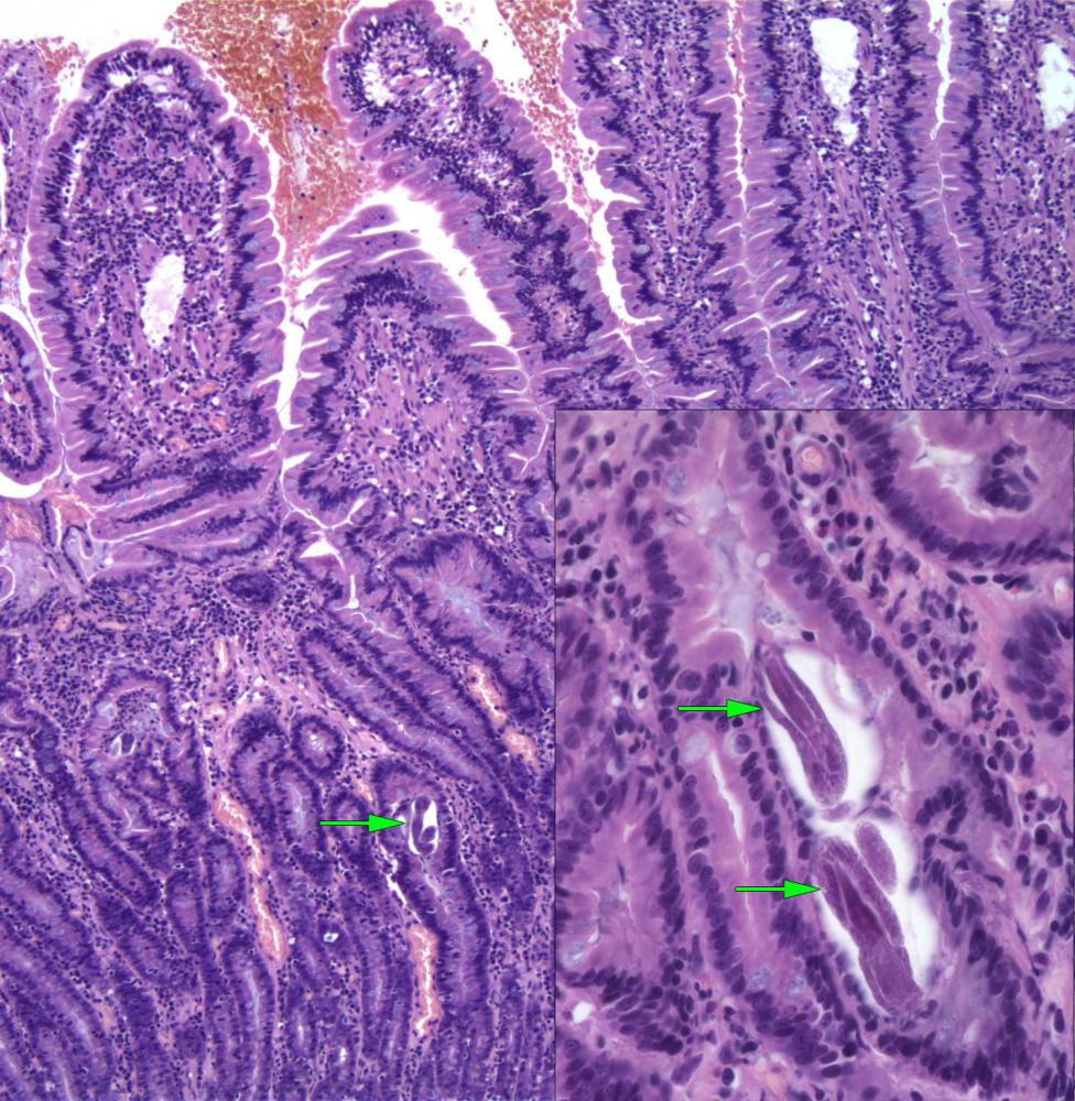 Image:Adult Strongyloides, small intestine, dog-Merck Veterinary Manual