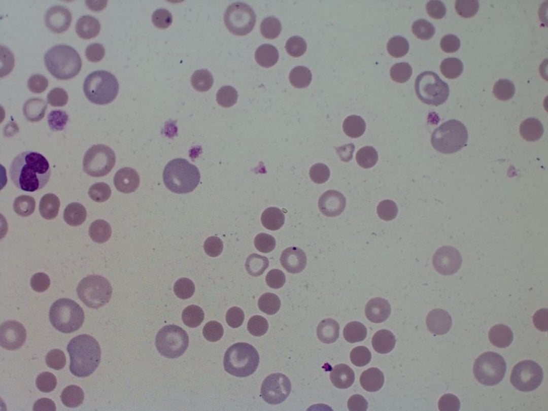 Overview of Anemia in Animals - Circulatory System - MSD Veterinary Manual