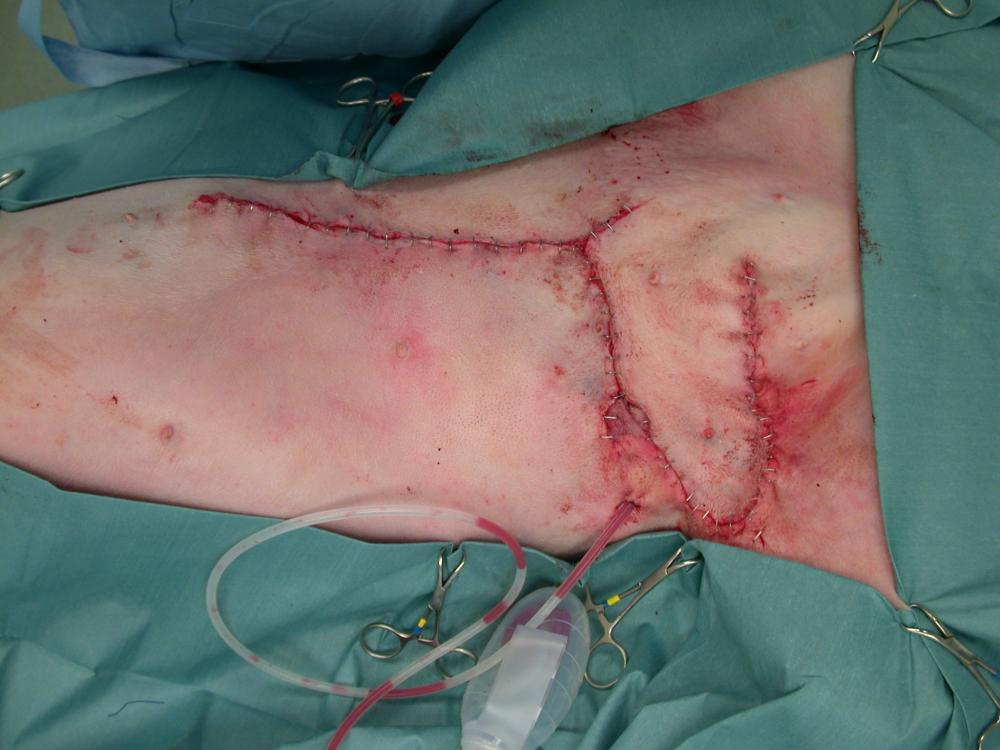 Image:Flap de padrão axial epigástrico superficial, pós-operatório, cão ...