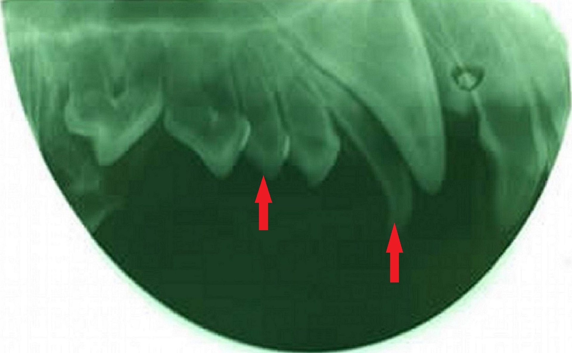 Anomalías congénitas y hereditarias de los dientes en animales ...