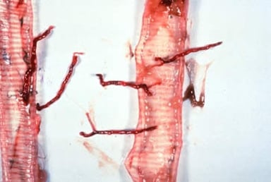 Image:Syngamus trachea worms, tracheal lumen, poultry-Merck Veterinary ...