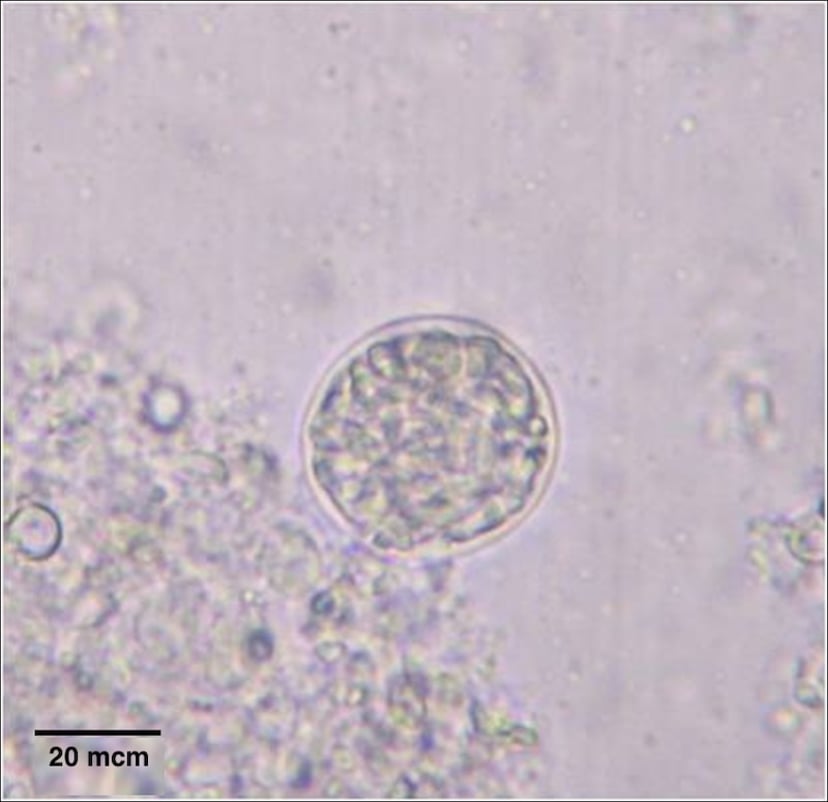 Toxoplasmosis in Animals - Infectious Diseases - MSD Veterinary Manual
