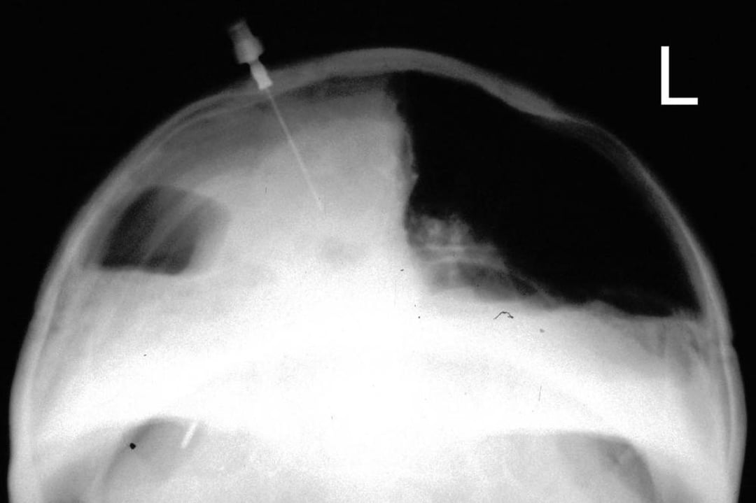 Image:Pulmonary candidiasis, tortoise-MSD Veterinary Manual