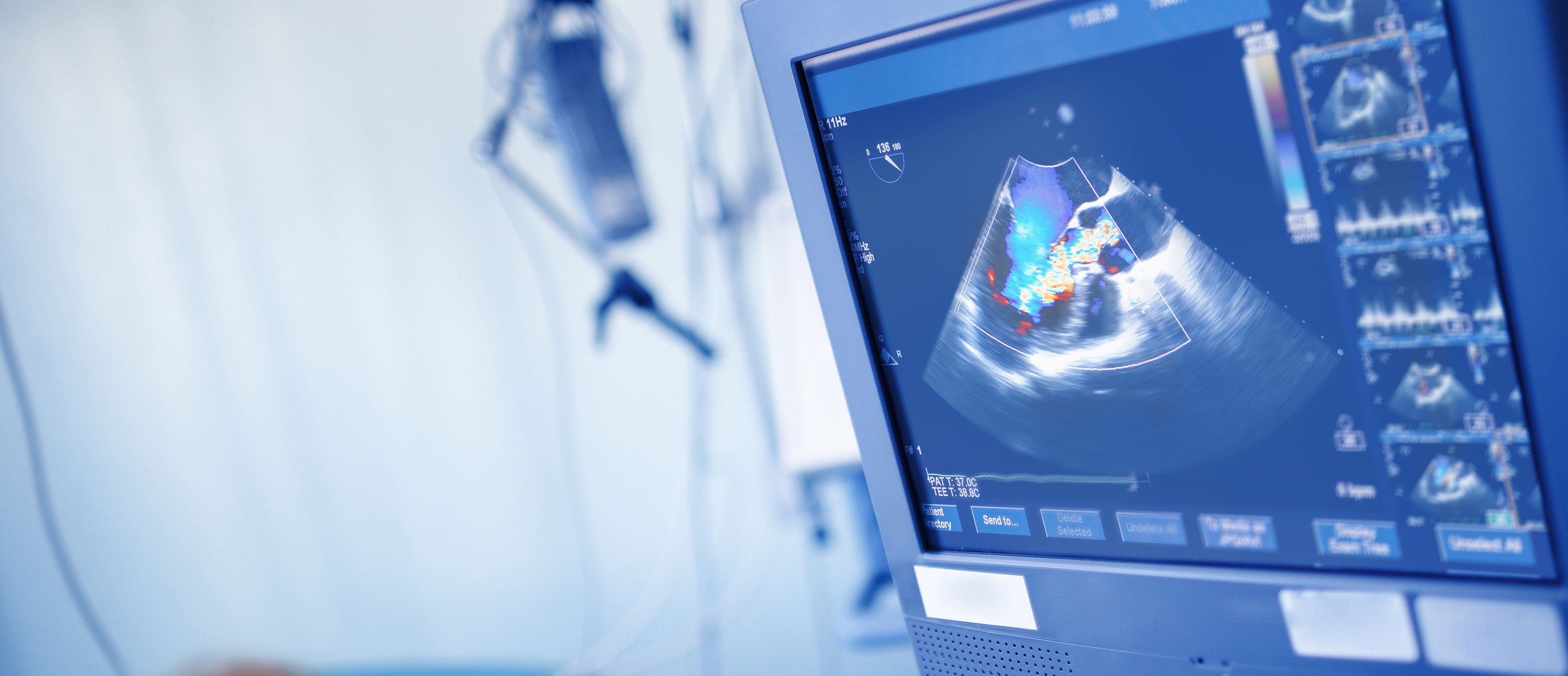 Cardiovascular Imaging and Diagnostic Services at Sutter Health