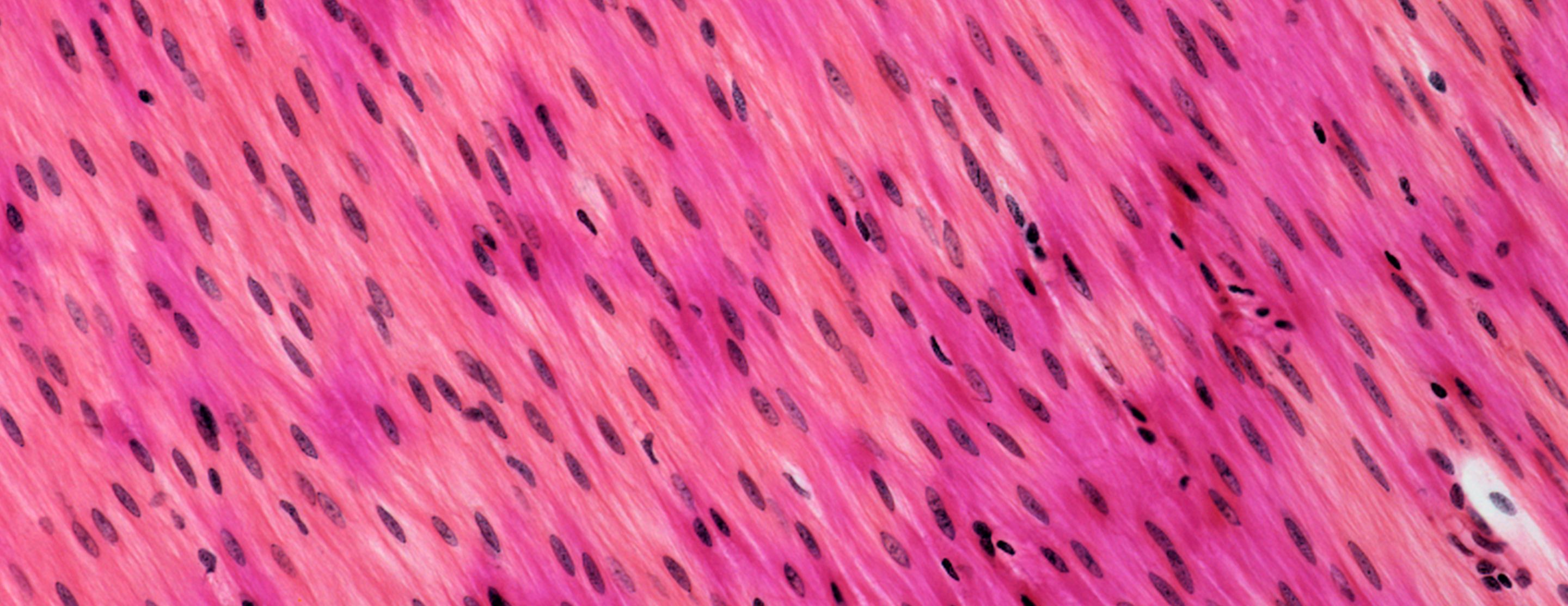 Anti-smooth muscle antibody | UCSF Health