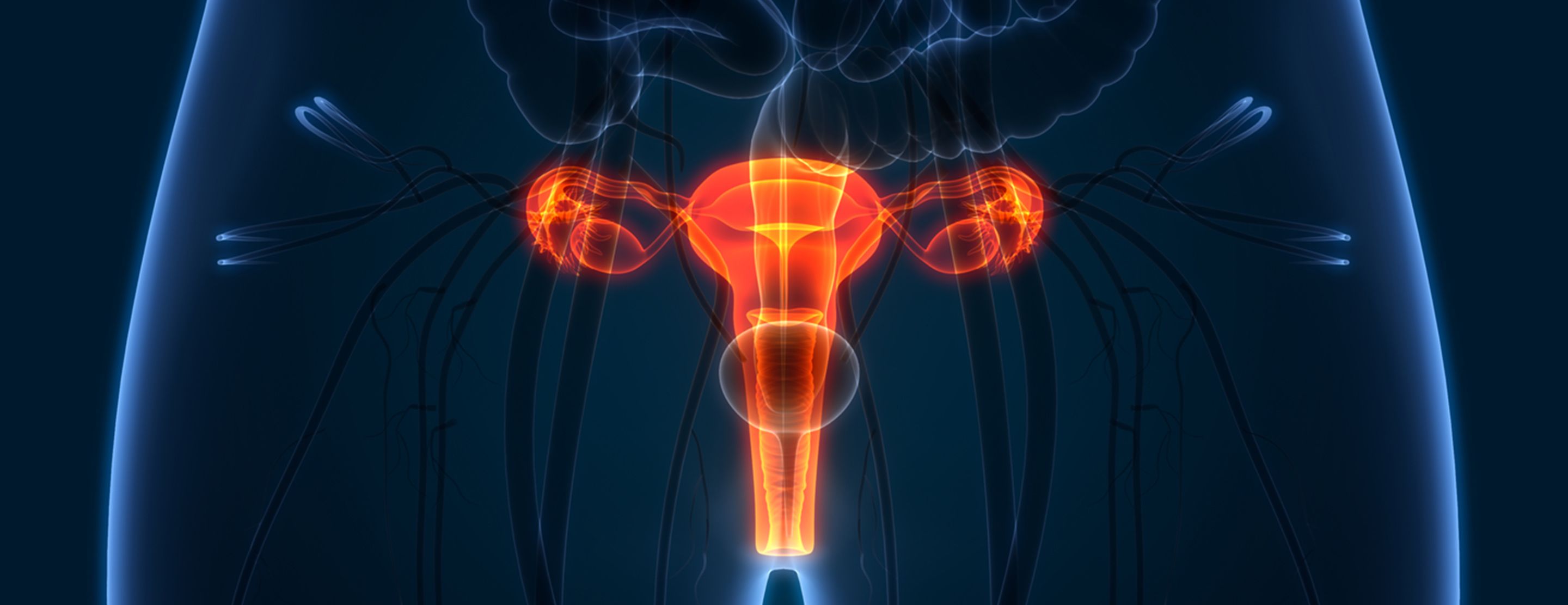 Cone biopsy | UCSF Health